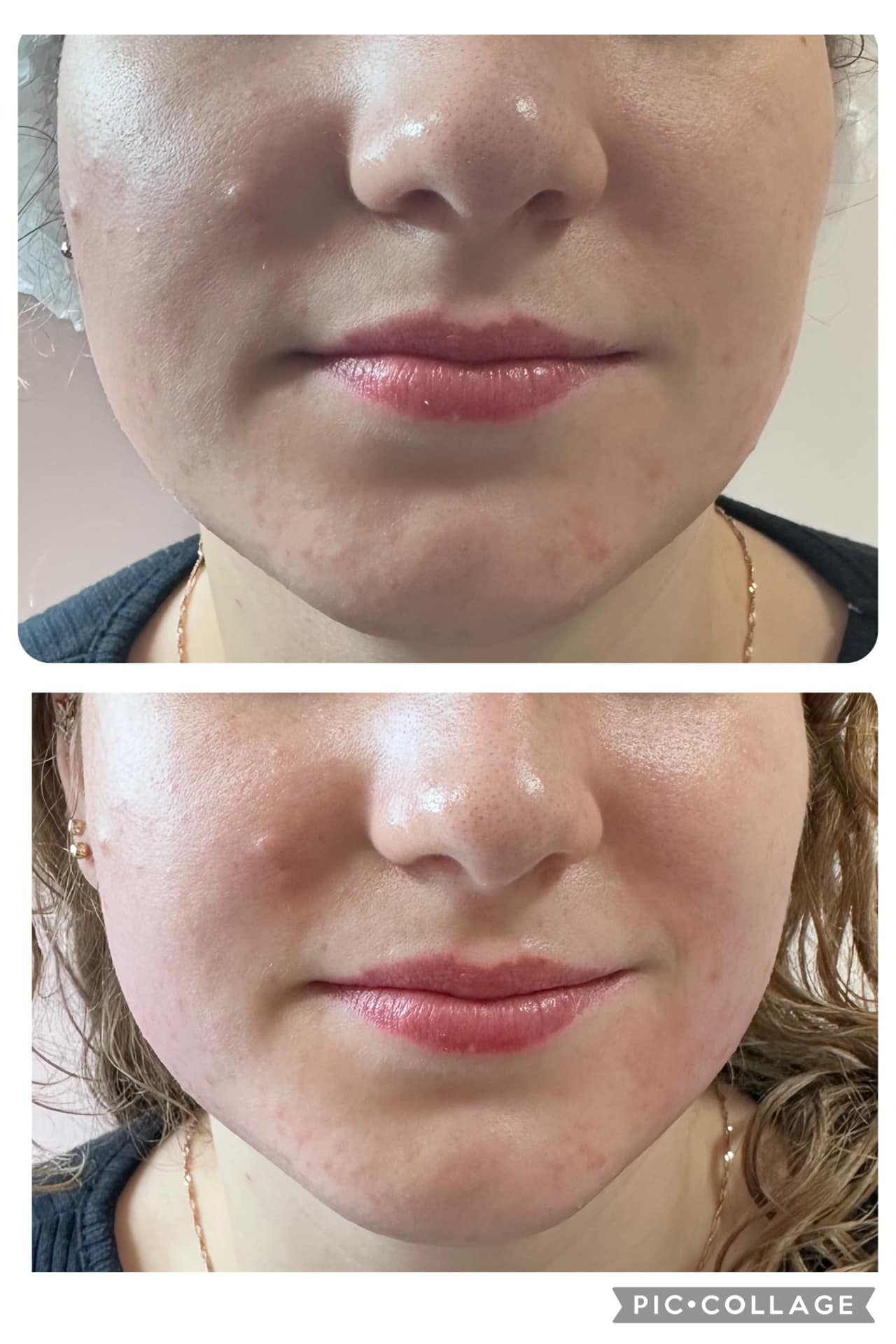 Laser nose hair removal City Center, Bialystok — 1 master — Prices ...